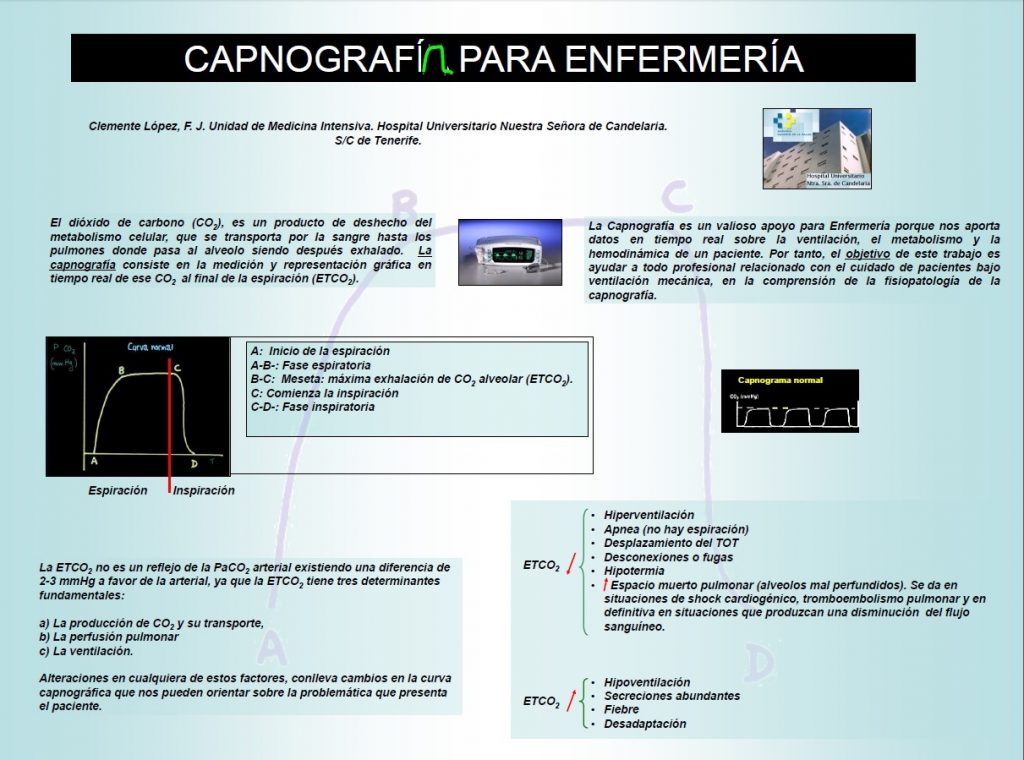 Capnografía - Web de ventilación mecánica para Enfermería